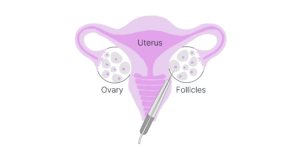 For Women and Families | Gameto