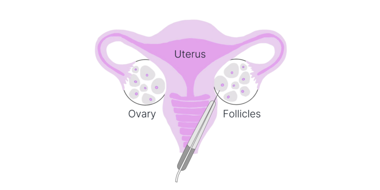 For Women and Families | Gameto